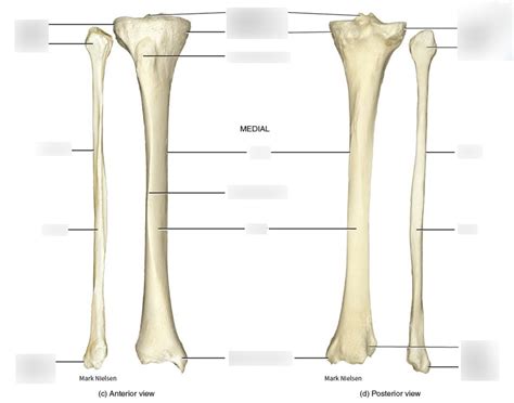 Ch 8 Anatomy Of Tibia And Fibula Disarticulated Diagram Quizlet