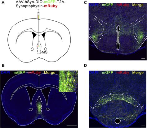 LH And SuM Receive Direct Projections From MS Vglut2 Neurons A