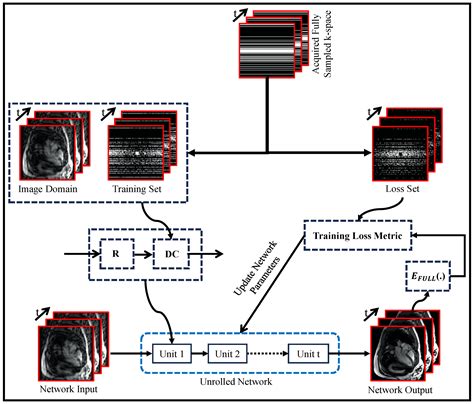 Deep Learning Mri Reconstruction Nqflwv