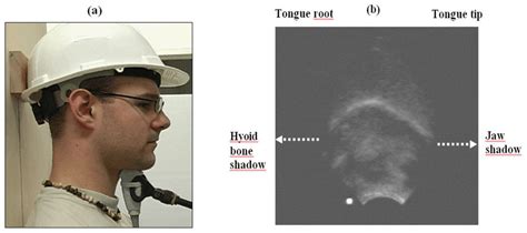 Experimental Setup A And Mid Sagittal Tongue Contour B Collected Download Scientific