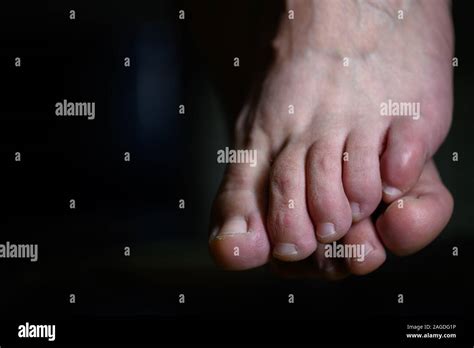 Piedi Sudati E Puzzolenti Immagini E Fotografie Stock Ad Alta