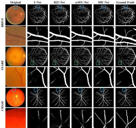 Comparative Results Of The Sota Methods And Our Proposed Mic Net On