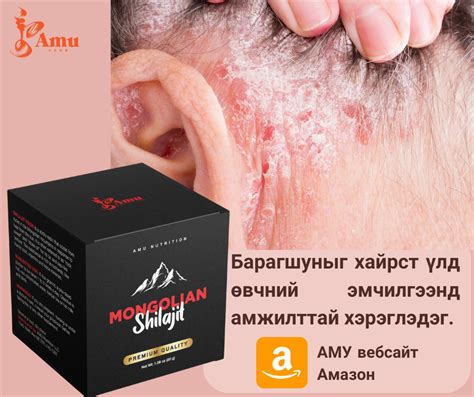 Amu Usa БАРАГШУН НЬ МАШ ОЛОН ӨВЧНИЙ ЭМЧИЛГЭЭНД ХЭРЭГЛЭГДДЭГ БИЛЭЭ