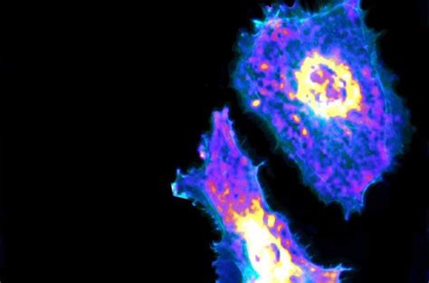 For The First Time Researchers Visualize Metabolic Process At The Single Cell Level