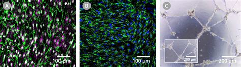 Human Ipsc Derived Endothelial Cells Expandable Ecs For Vascular