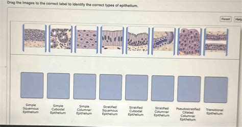 Solved Drag The Images To The Correct Label To Identify The Correct Types Of Epithelium Reset