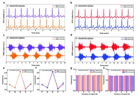 The Biopotential Signals Of Ecg And Emg With The Wpd Electrodes And Download Scientific Diagram