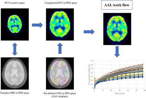 Compare The Ipsilateral And Contralateral Regions Between Patients Download Scientific