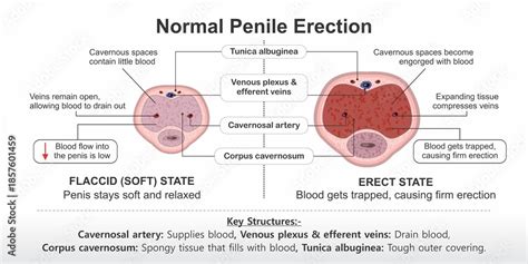 Normal Penile Erection Flaccid Vs Erect State Stock Illustration
