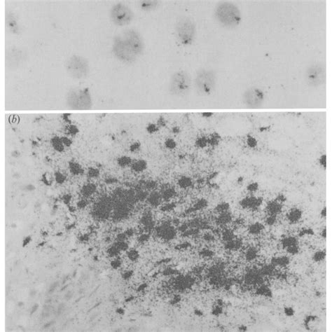 In Situ Hybridization Detection Of Ebv Dna A Aw Ramos Cells 1 Ebv Download Scientific