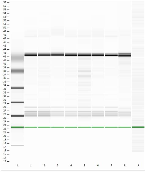 Why Is There Only One Peak At 18s But Almost No 28s In The Bioanalyzer Results Researchgate