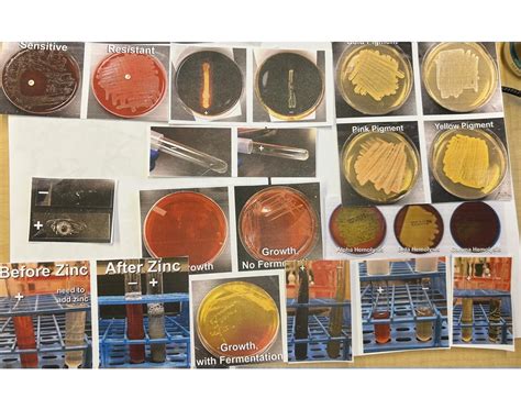 Microbiology Examples — Printable Worksheet