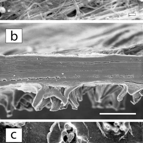 The Sem Micrographs A The Bottom Surface ×6000 Bar 1 Micron B