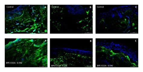 Extracellular Matrix Elements Evaluation A Collagen And Elastin Download Scientific Diagram