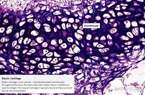 组织胚胎学总结：软骨 知乎