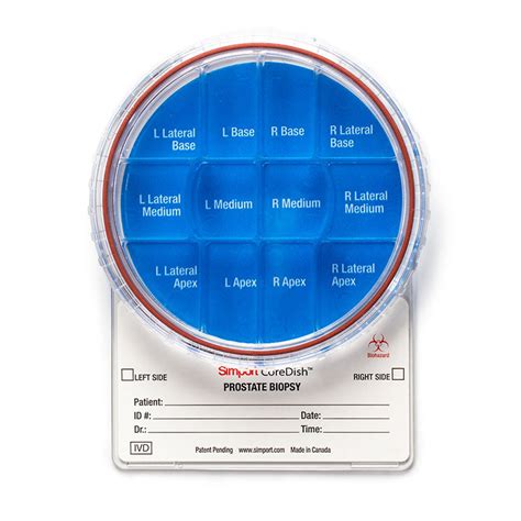 M970 Dxp Prostate Biopsy Container