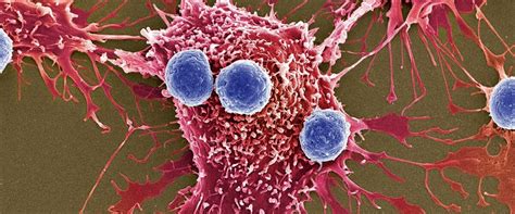 Что такое метастазы и как с ними бороться Простая генетика Дзен