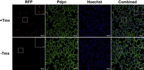 The Lipid Transporter Mfsd2a Maintains Pulmonary Surfactant Homeostasis