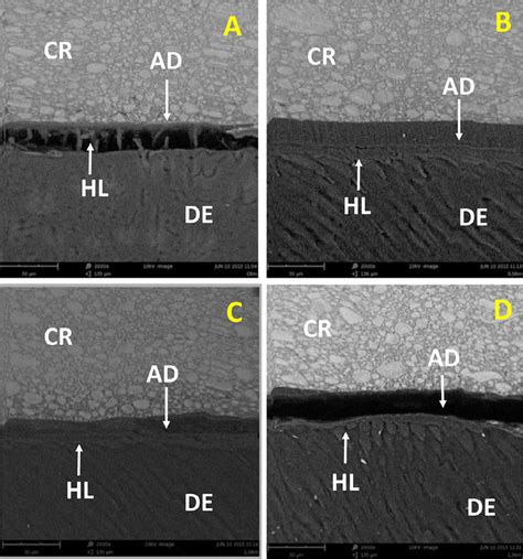 Photomicrographs Of The Bonding Interface Between Dentin De And Download Scientific Diagram