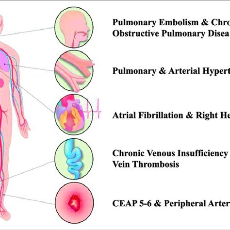 Illustration Of Co Morbidities Associated With Venous Leg Ulcers In
