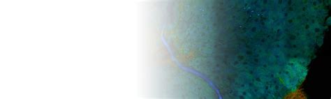 Fluorescence Lifetime Imaging Microscopy Hamamatsu Photonics