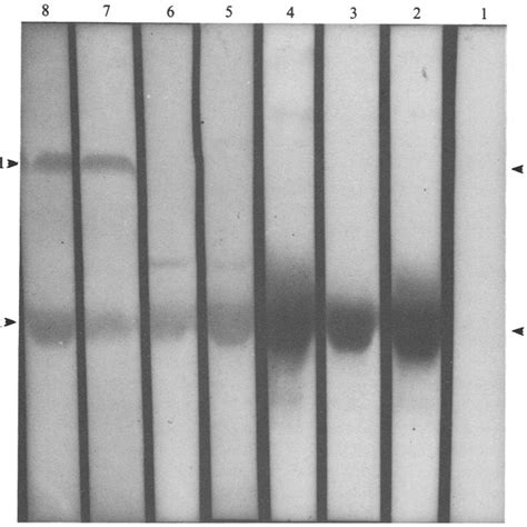 Western Blot Analysis Of Rabbit Sera The Antigens Were The Vp 1 And