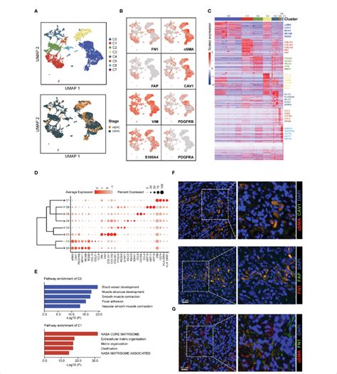 Identification Of Cafs Subtypes In Prostate Cancer Microenvironment
