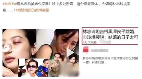 林志玲被爆遭akira打爛鼻子住院 她首回應 鏡週刊 Mirror Media