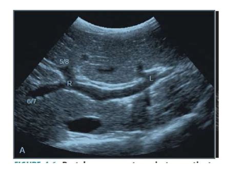 Hepatobiliary Imaging Anatomy Radiology Pptx