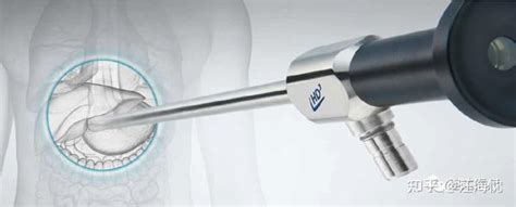 Henke Sass Wolf－内窥镜业务介绍 知乎