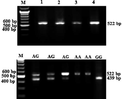 The Genotyping Of A G Single Nucleotide Polymorphisms Snps In Leptin