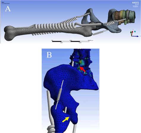 Finite Element Analysis In An Ischiofemoral Impingement Model Derived Download Scientific