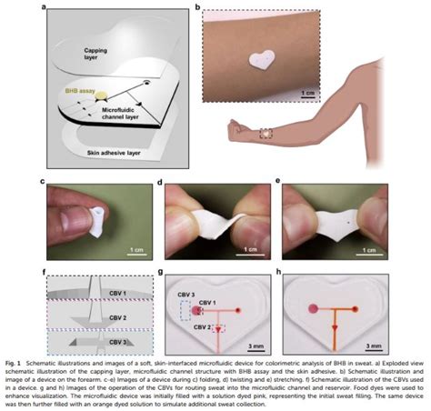 Microtech Ventures On Linkedin Skin Interfaced Microfluidic Biosensors For Colorimetric