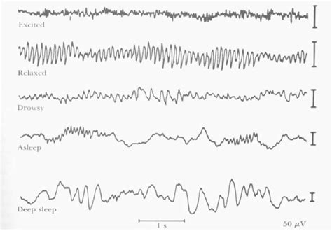 Sample Eeg Signal 9 Download Scientific Diagram
