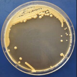 Sputum Culture Showing White Smooth Colonies Of Cryptococcus Neoformans Download Scientific