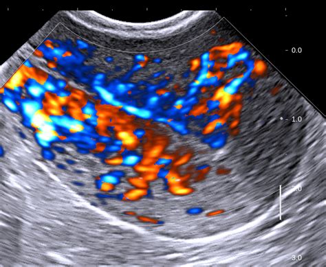 The Art Of Ultrasound