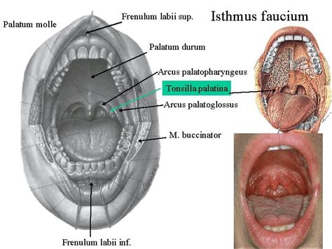 Isthmus Fautium Gaumen Rachen Und Gebiete Um Rachen