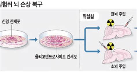 방사선에 손상된 뇌 줄기세포로 복구
