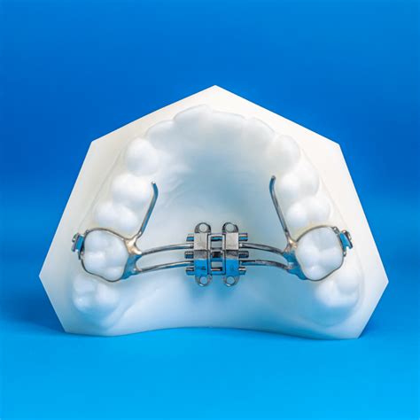 Mse Expander Specialty Appliances