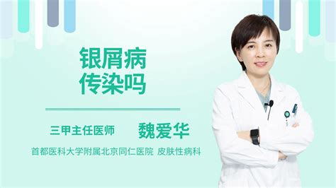 有牛皮癣会遗传吗 杏林普康