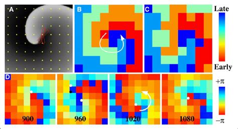 Phase Mapping And Isochronal Mapping Of Atrial Fibrillation A Download Scientific Diagram
