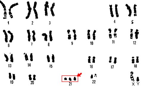 Aneuplody Assignment Help Homework Help Online Live Biology Tutoring Help