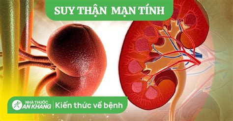 Triệu chứng và cách điều trị suy thận mạn tính là gì bạn cần biết