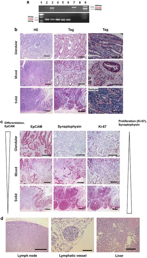 Vil Cre Ert2 × Loxp Tag Mice Spontaneously Develop Cre Recombinase Download Scientific Diagram