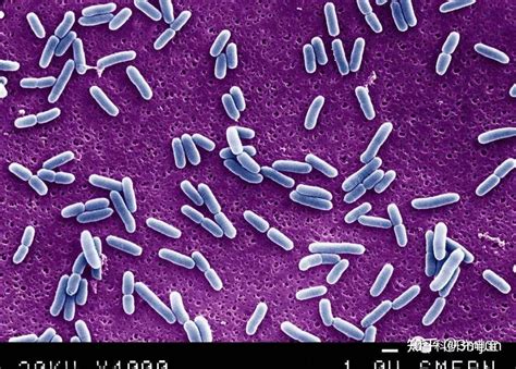如何统计一大片孔洞、颗粒或者细胞等密集物的数量和大小分布？ 知乎