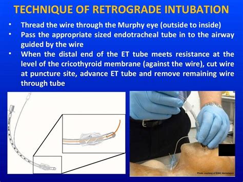 Retrograde Intubation Difficult Intubation Pdf