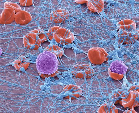 Picc Line Internal Surface Sem Bild Kaufen 13743097 Science Photo Library