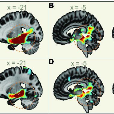 Sex Specific Pathological Features Sagittal View Highlighted Areas Download Scientific Diagram