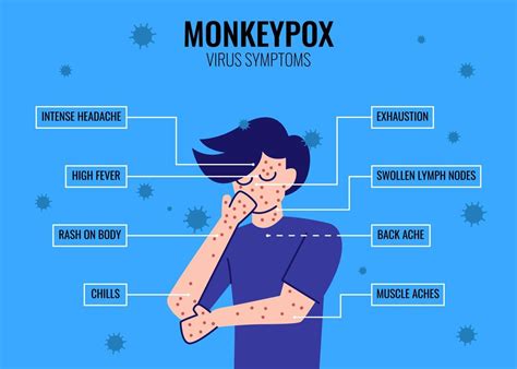Monkeypox Virus Symptoms Infographic Monkeypox Virus Preventive