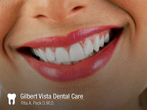 Types Of Tooth Stains Does Teeth Whitening Remove Them